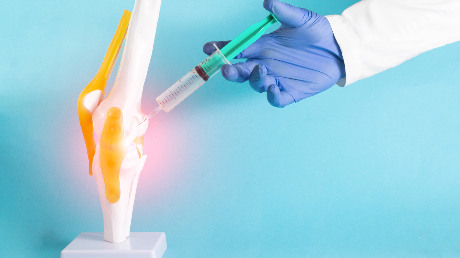 What Are Hyalgan Injections - MEDICA DEPOT