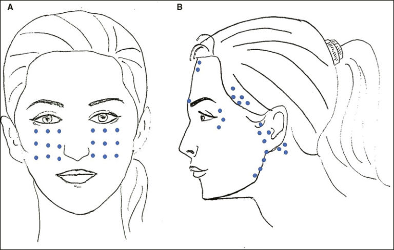 Entyvio Side Effects - A Complete List - MEDICA DEPOT